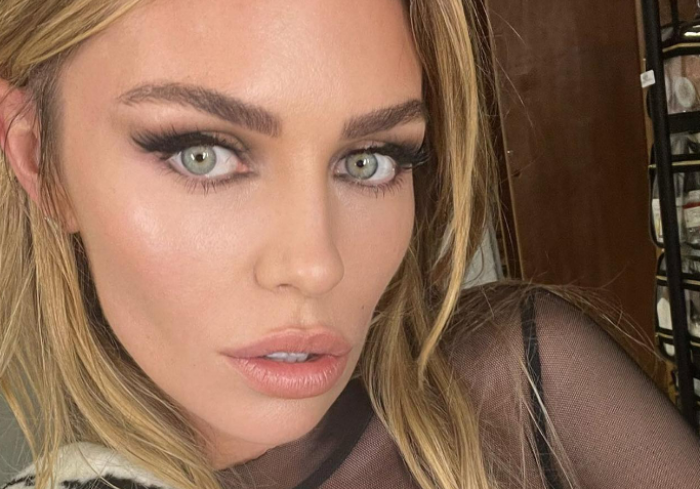 Model Abbey Clancy details daughter’s ‘scary’ health diagnosis | SHEmazing!