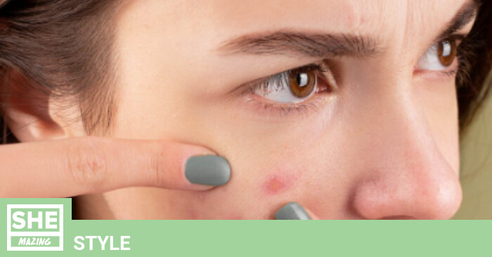 Everything you need to know about breakouts this Acne Awareness Month ...